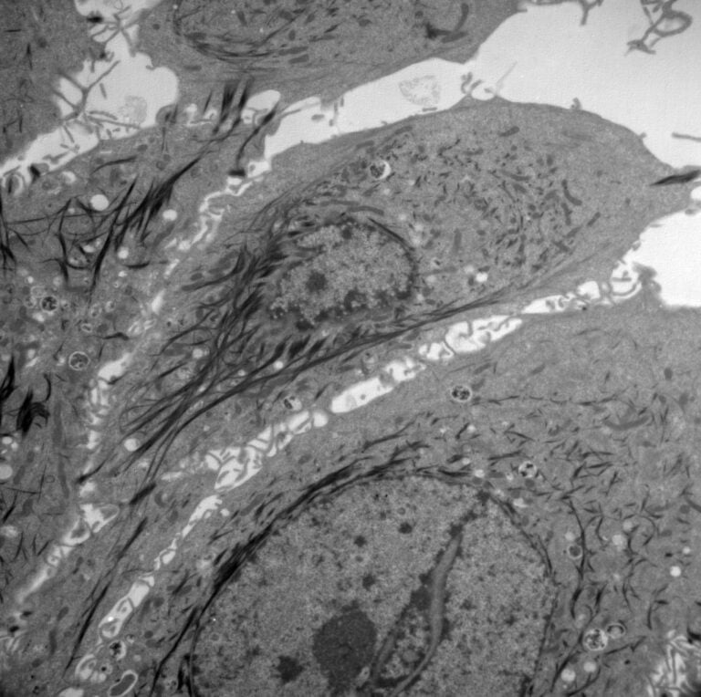 PHEM Buffer - EM Grade