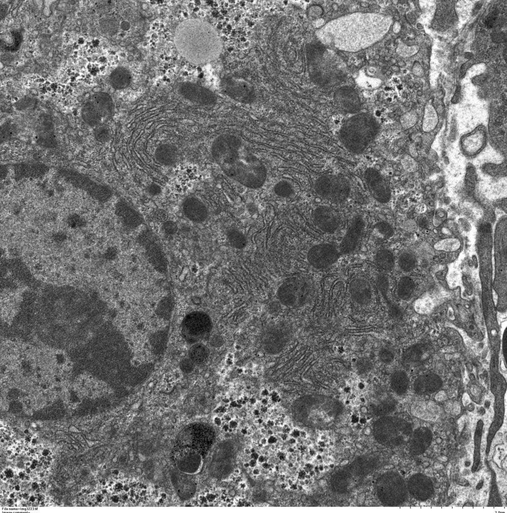 Paraformaldehyde (PFA) (2% - 4%), Glutaraldehyde (2% - 2,5%) in 0,1M Buffer - KARNOSKY in buffer ...