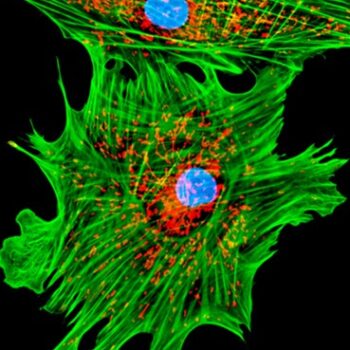PHEM BUFFER , the best buffer for immunofluorescence cell culture. - EM Grade